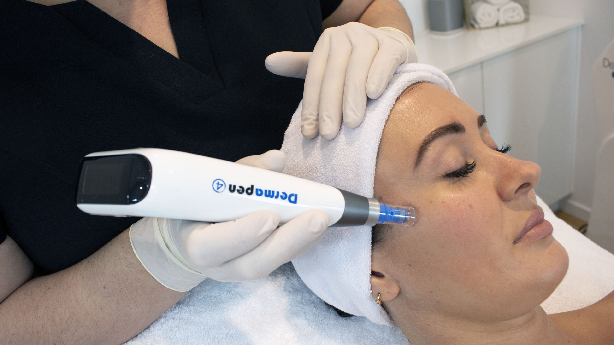 What is Dermapen Skin Needling & Why Should You Do It?